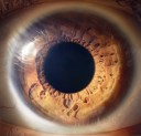 This Bionic Lens Implant Could Give Everybody Perfect Vision | Fortune