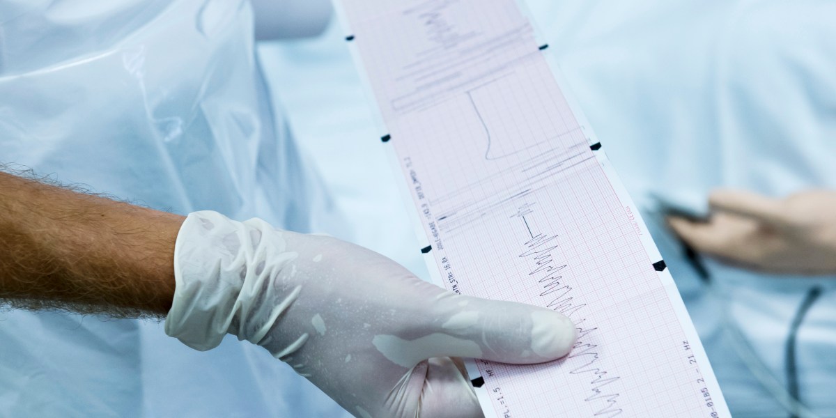 Brainstorm Health: How to Find a Heart Attack Long Before It Happens ...