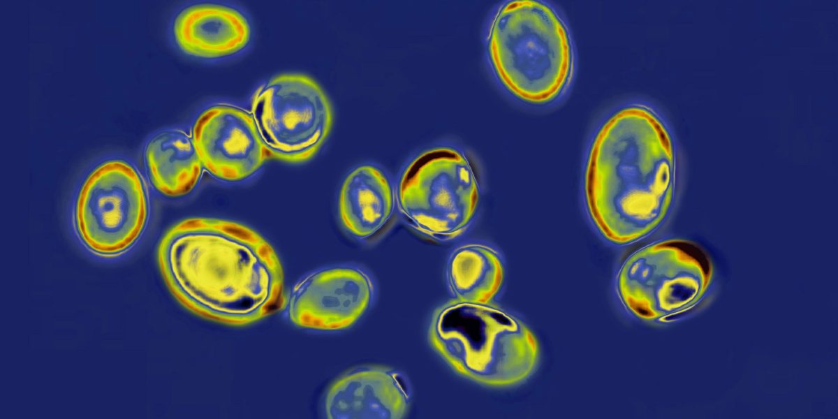Candida auris fungal infection sweeps across U.S.: Here's what to know ...