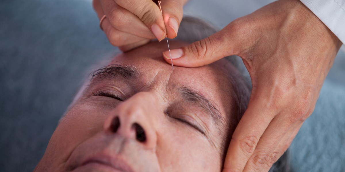 Does Medicare cover acupuncture? | Fortune Well